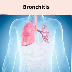 Know about Bronchitis: Inflammation of the Bronchial Tubes ...